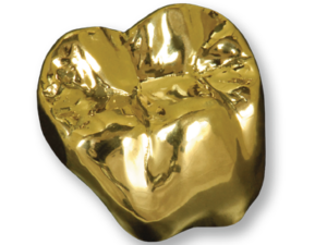Types of dental crowns and cost: A complete guide to 2025